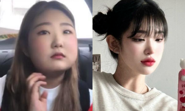 최고의 성형은 다이어트라더니…86㎏→55㎏ 최준희 변천사
